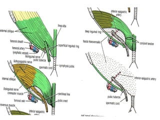 Superficial Inguinal Ring Surface Marking