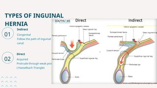 Introduction to anatomy of inguinal hernia | PPTX