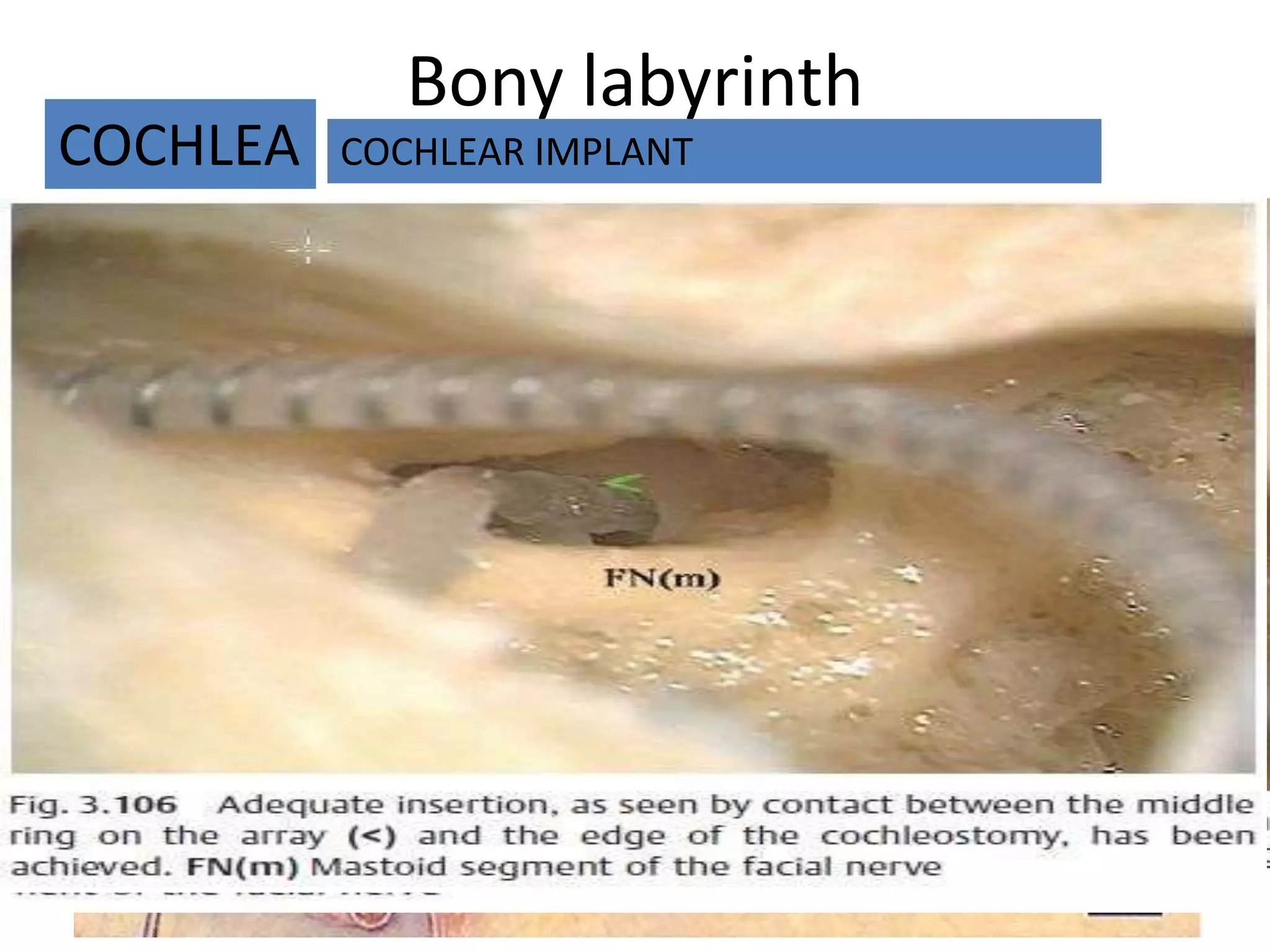 Anatomy of inner ear hk | PPTX