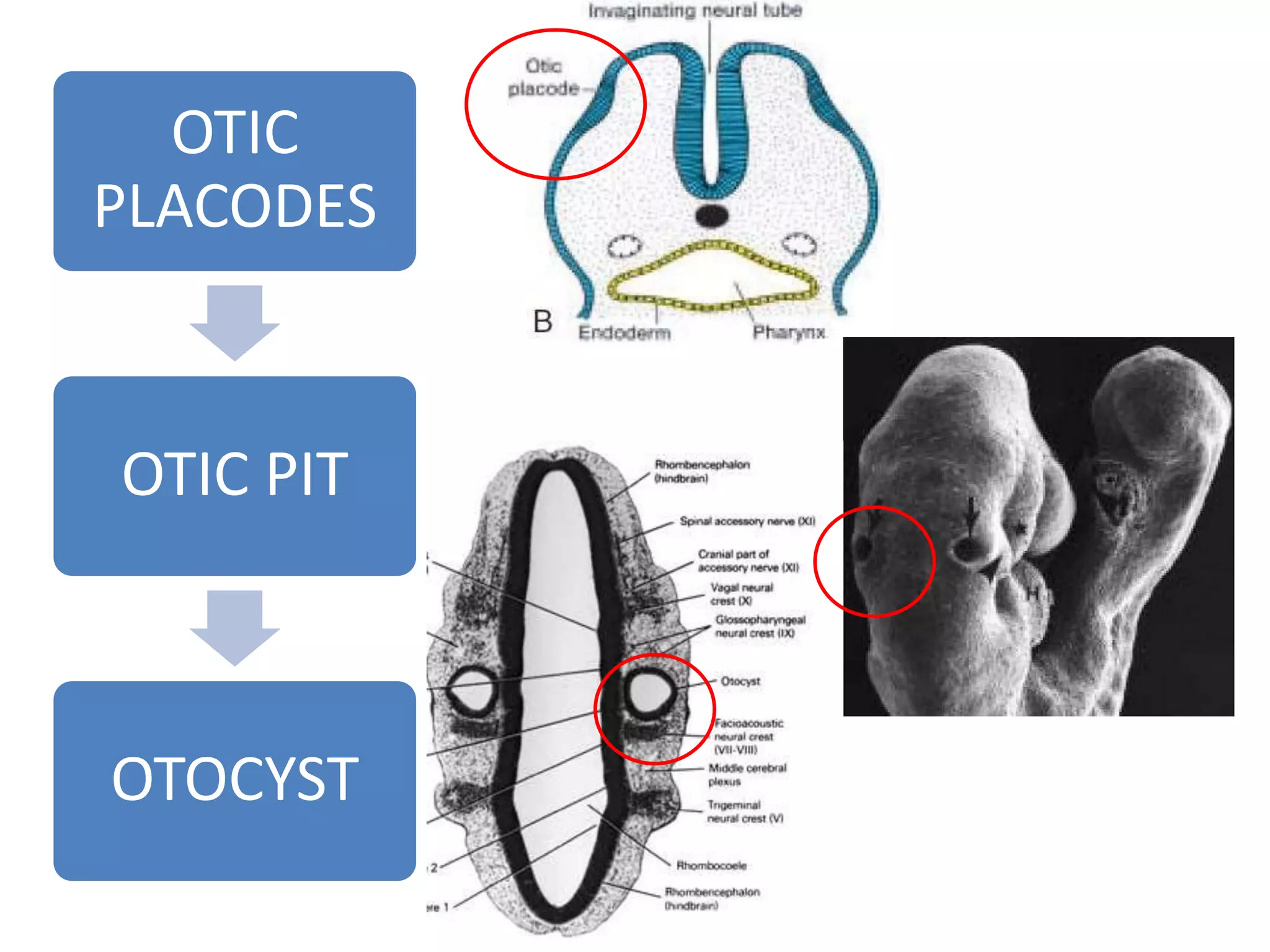 Anatomy of inner ear hk | PPTX