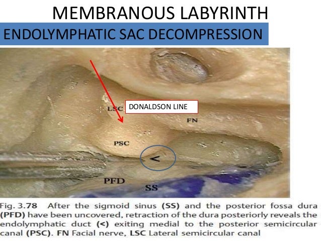 Anatomy of inner ear hk