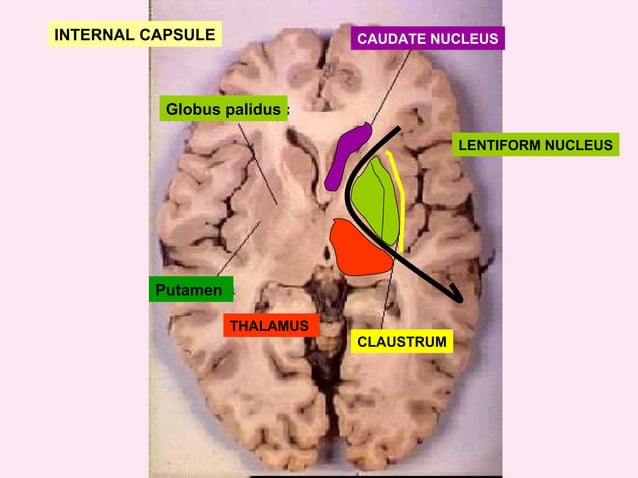 Anatomy of internal capsule | PPT