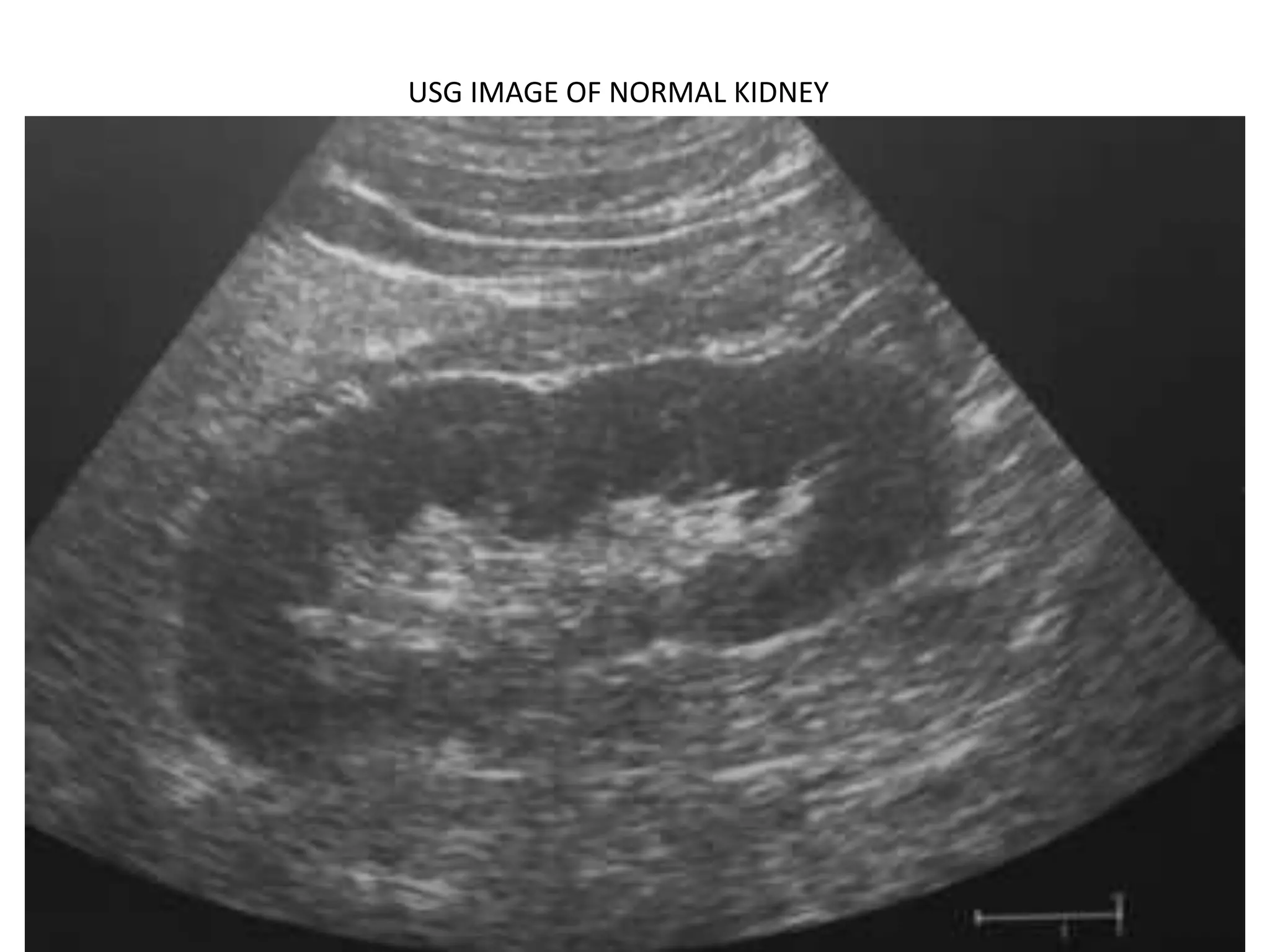 ANATOMY OF KIDNEY.pptx