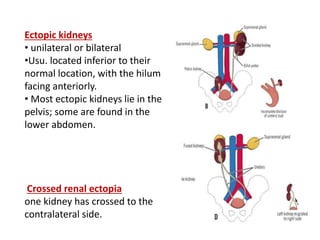 Anatomy of kidney nd ureter copy | PPTX