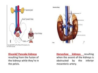 Anatomy of kidney nd ureter copy | PPT