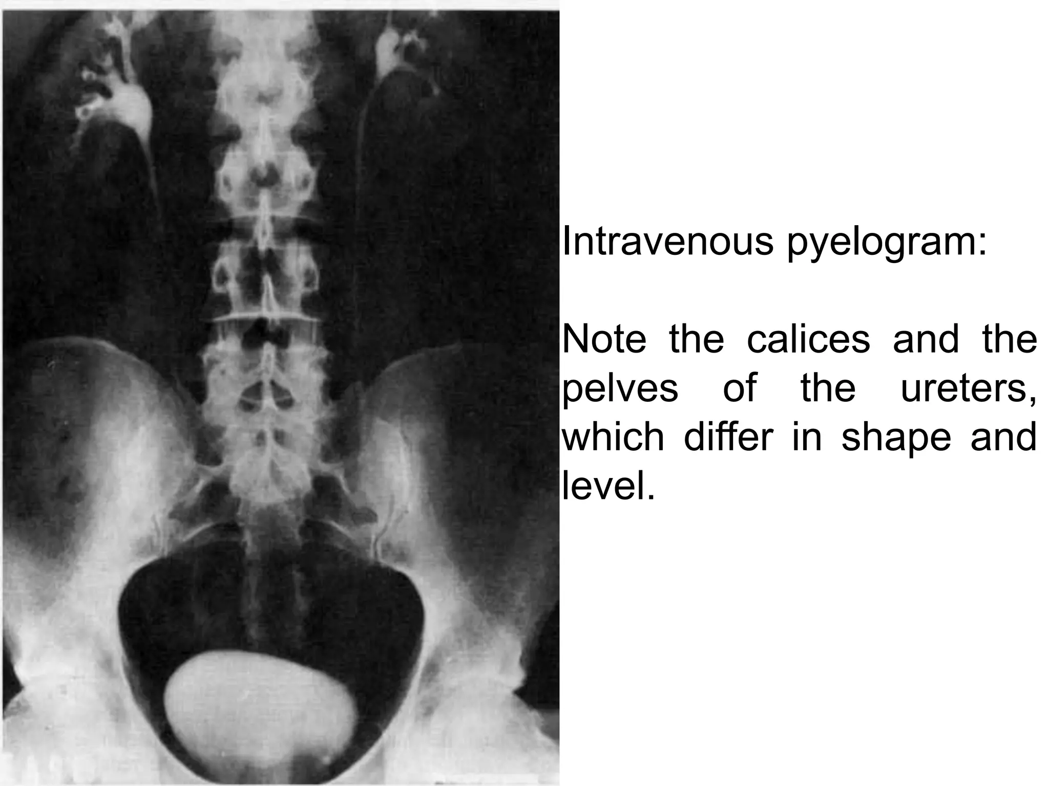 Anatomy of kidneys | PPTX
