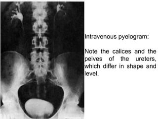 Anatomy of kidneys | PPTX