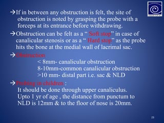 Anatomyoflacrimalapparatus 160313074220 | PPTX