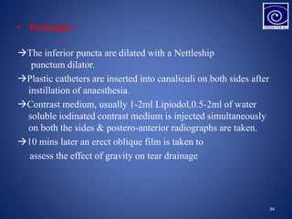 Anatomyoflacrimalapparatus 160313074220 | PPTX