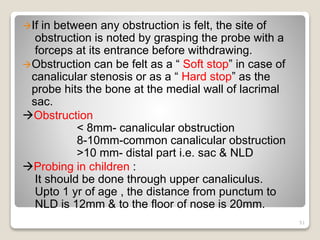 Anatomyoflacrimalapparatus 160313074220 | PDF