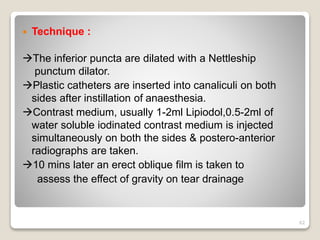 Anatomy of lacrimal apparatus | PPTX