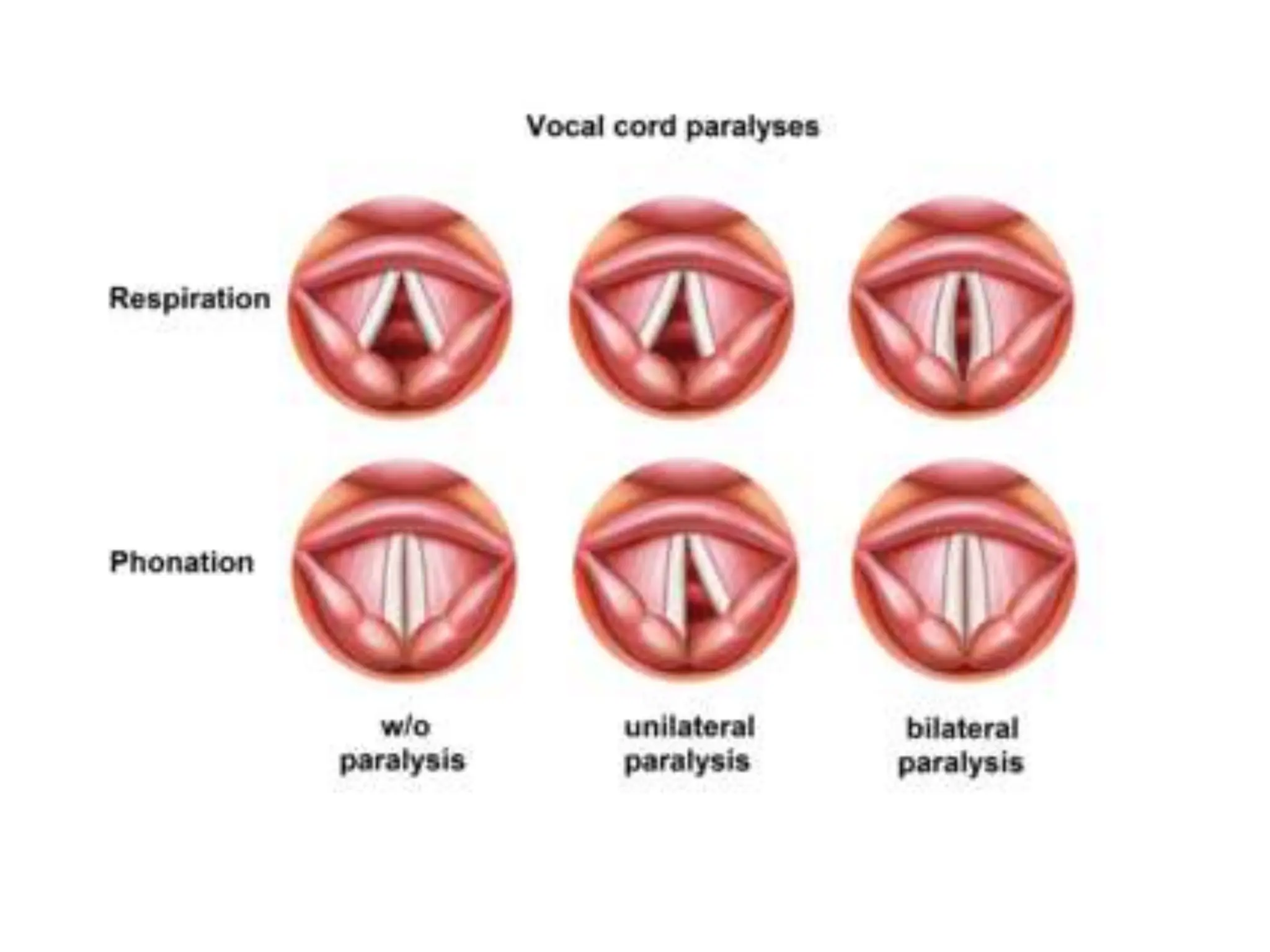 ANATOMY AND FUNCTIONS OF LARYNX-1...pptx