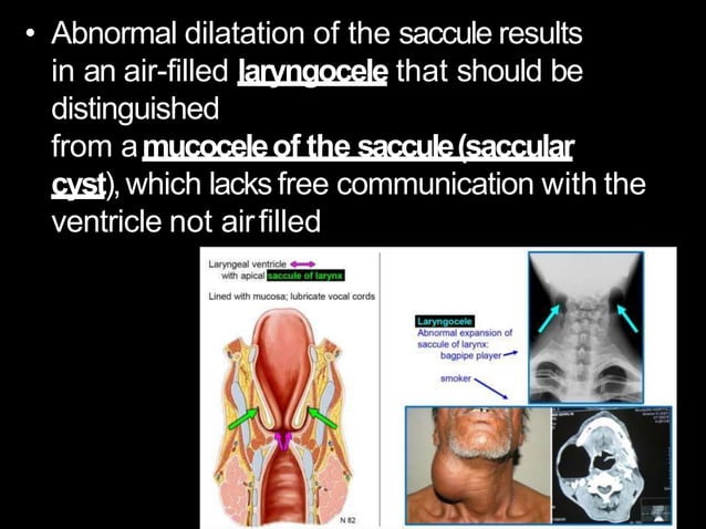 Anatomy Of Larynx(Voice Box) | PPTX | Thyroid Disorders | Endocrine and ...