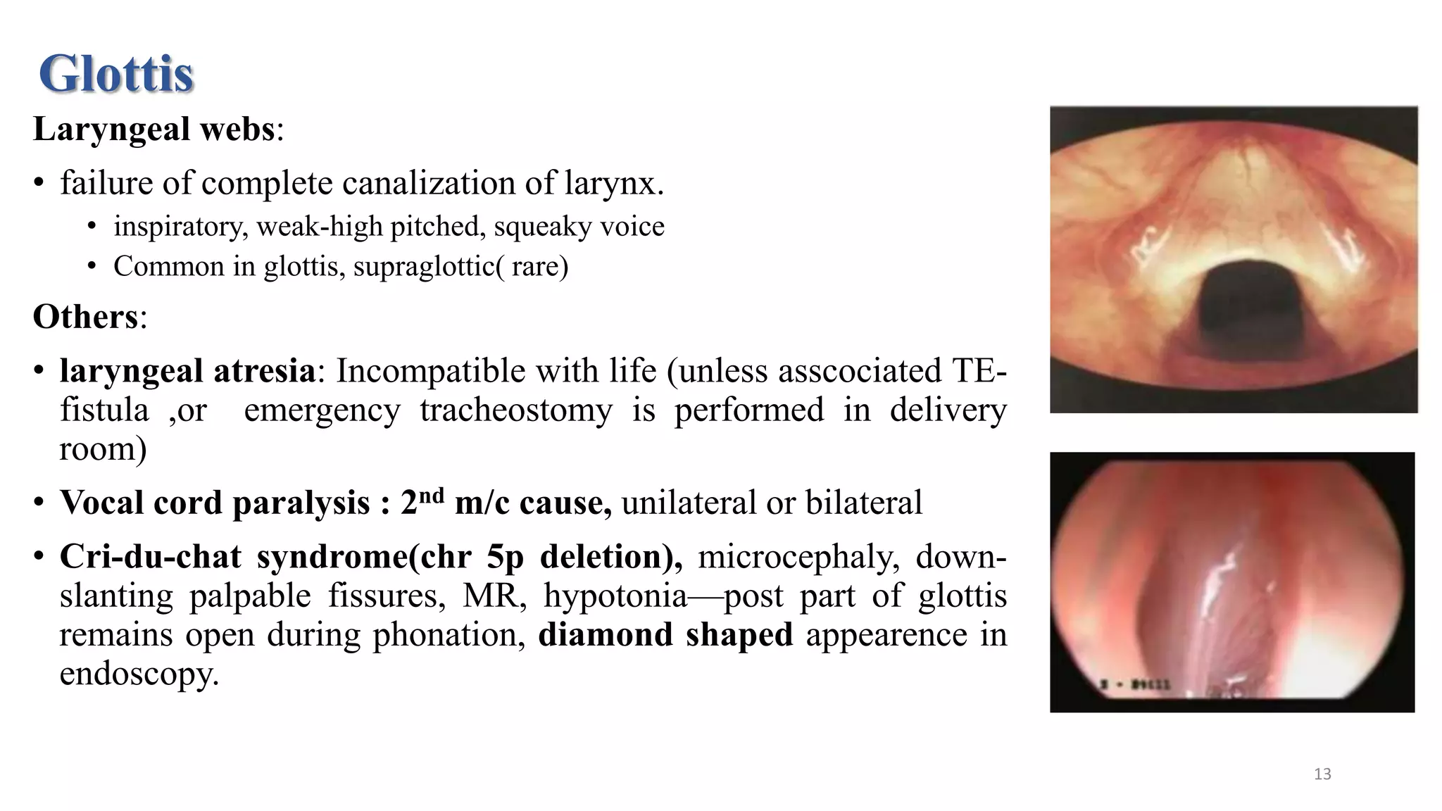 Anatomy of larynx and tracheobronchial tree | PPTX