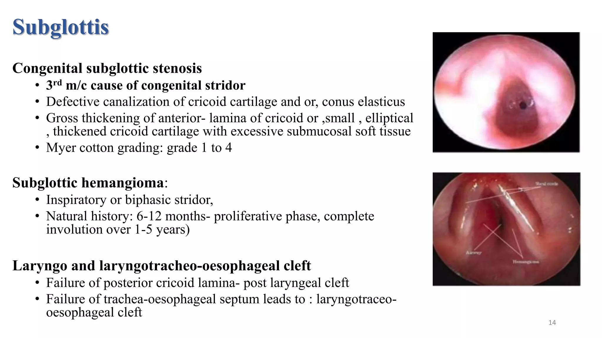 Anatomy of larynx and tracheobronchial tree | PPTX
