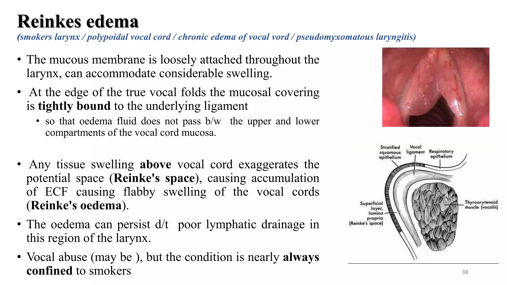 Anatomy of larynx and tracheobronchial tree | PPTX