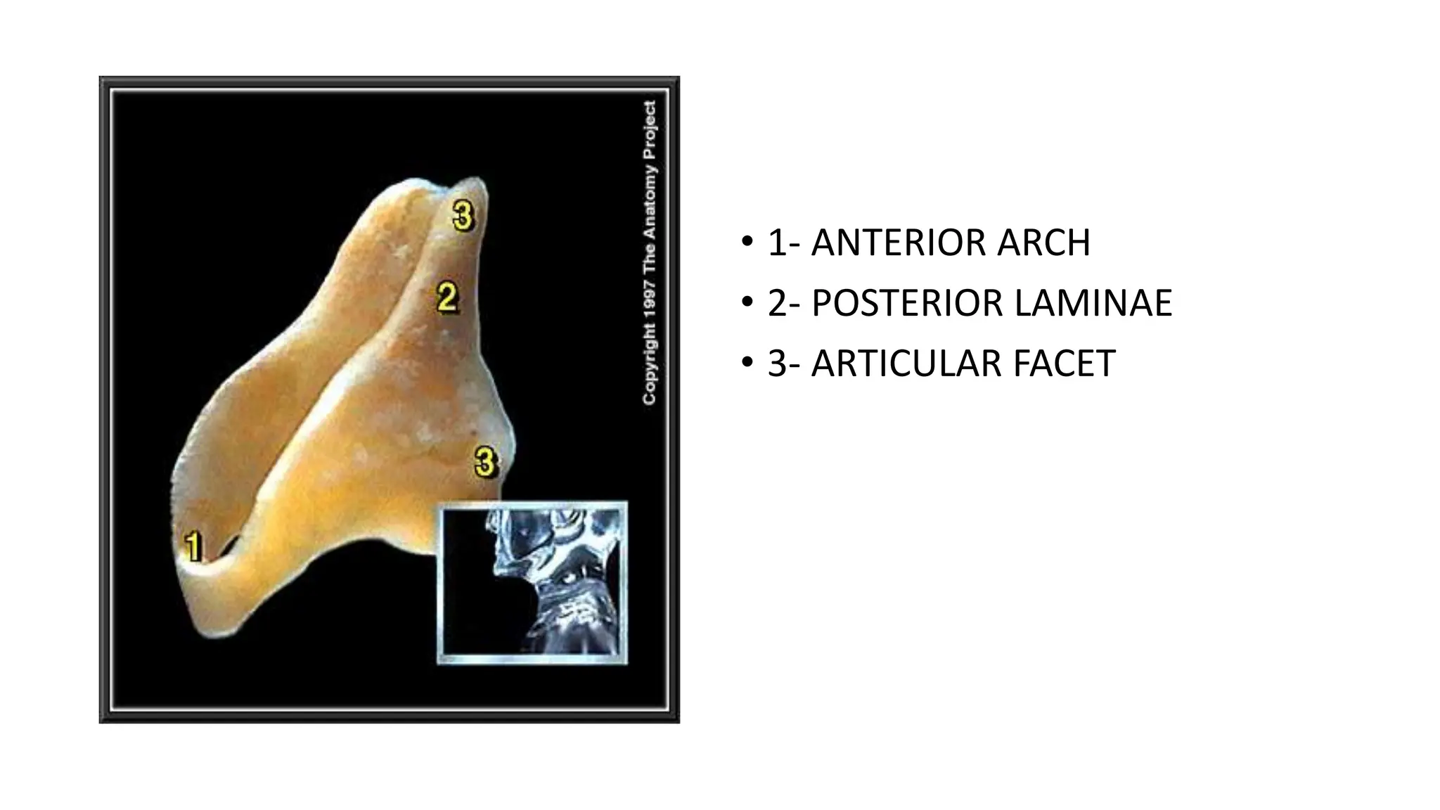 ANATOMY OF LARYNX, VOCAL CORD PALSIES ,.pptx