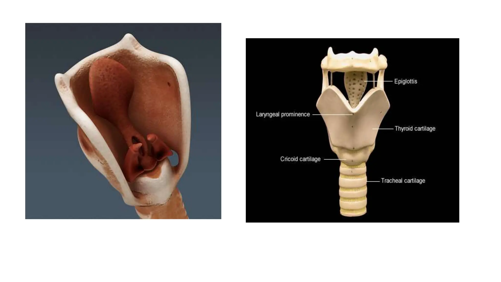 ANATOMY OF LARYNX, VOCAL CORD PALSIES ,.pptx