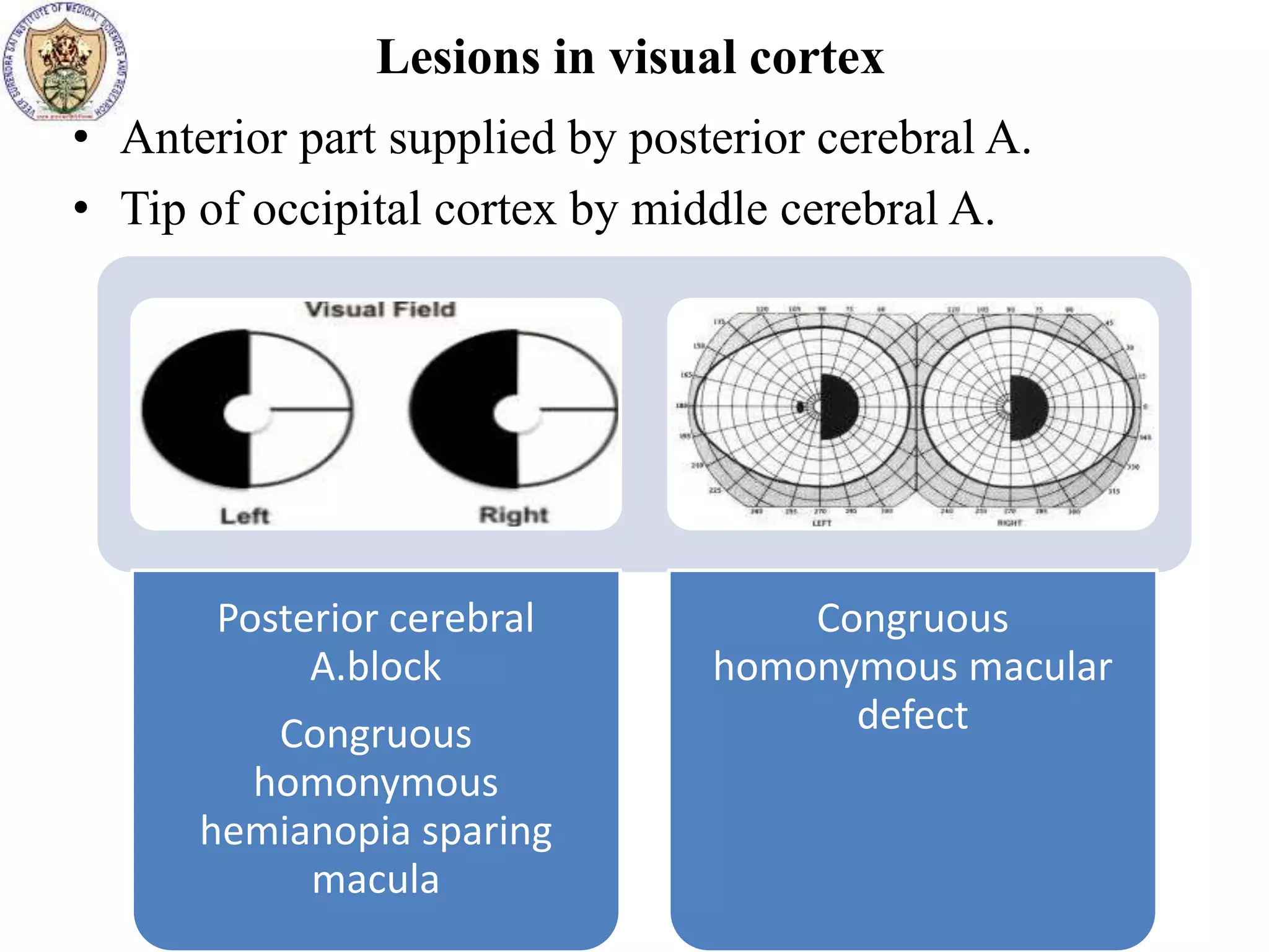 Anatomy of lateral geniculate body and visual cortex | PPTX