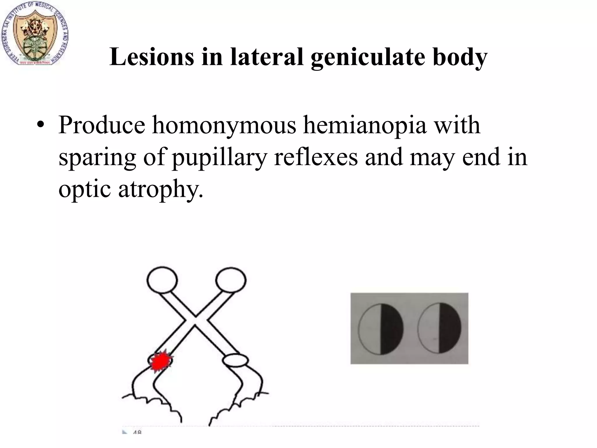 Anatomy of lateral geniculate body and visual cortex | PPTX