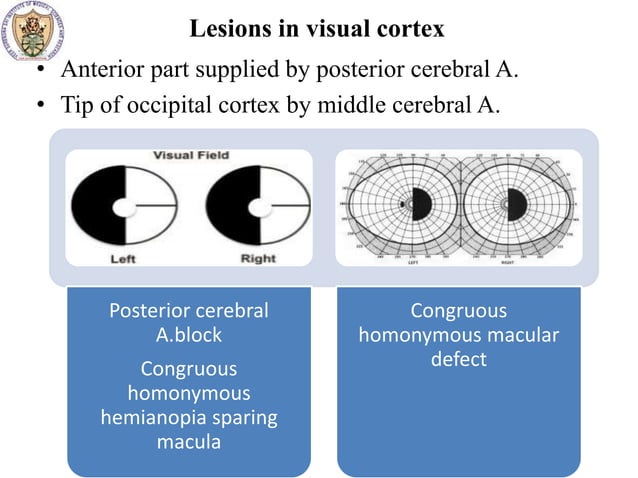 Anatomy of lateral geniculate body and visual cortex | PPTX | Brain and ...