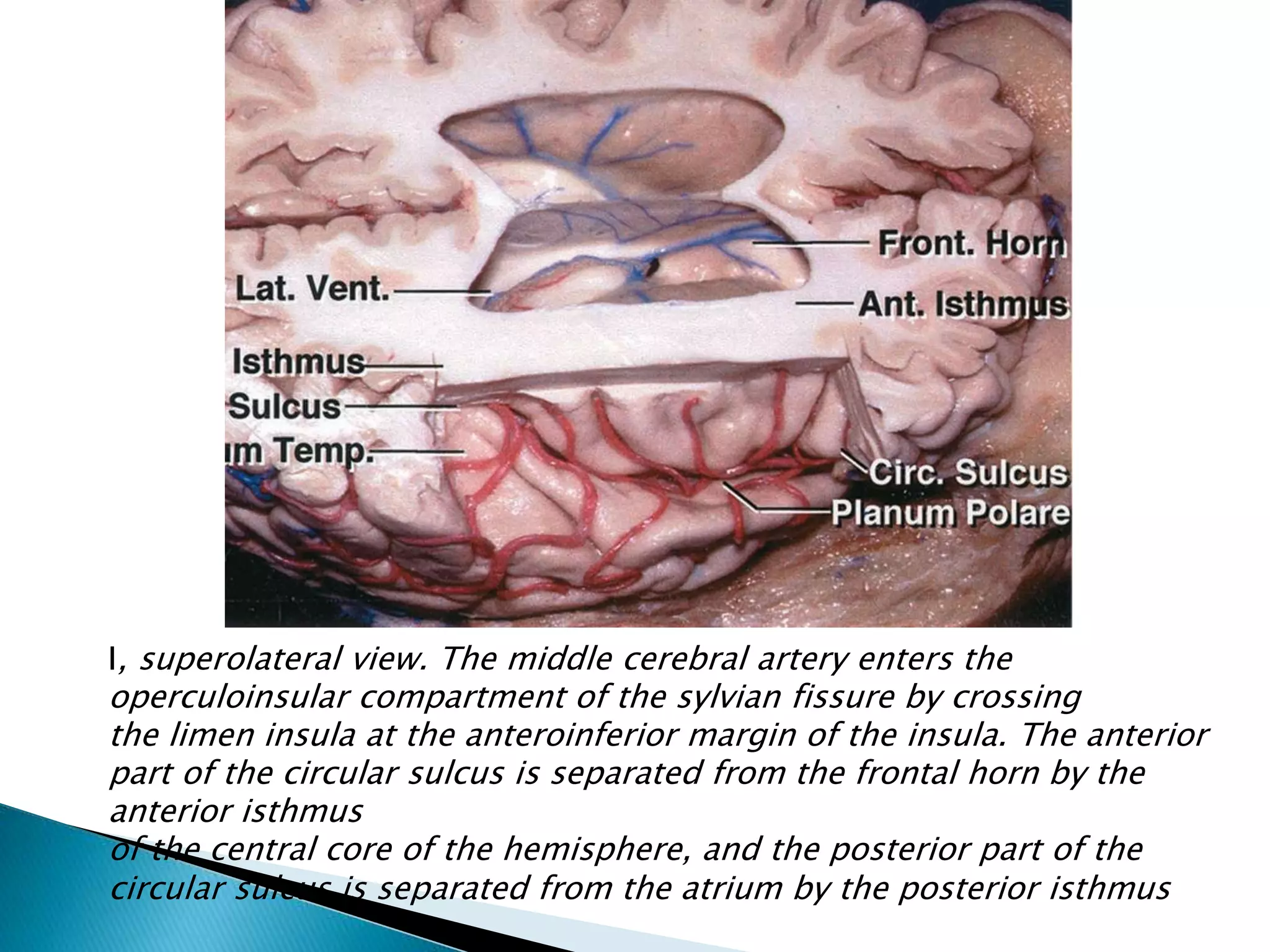 Anatomy of lateral ventricle | PPTX