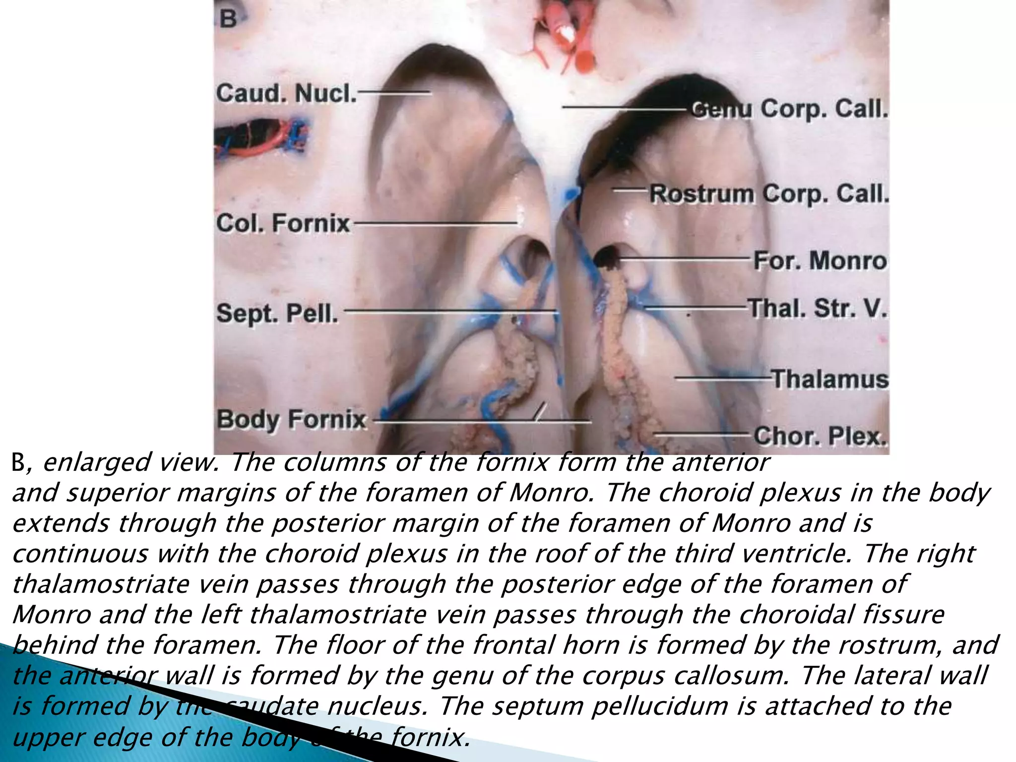 Anatomy of lateral ventricle | PPTX