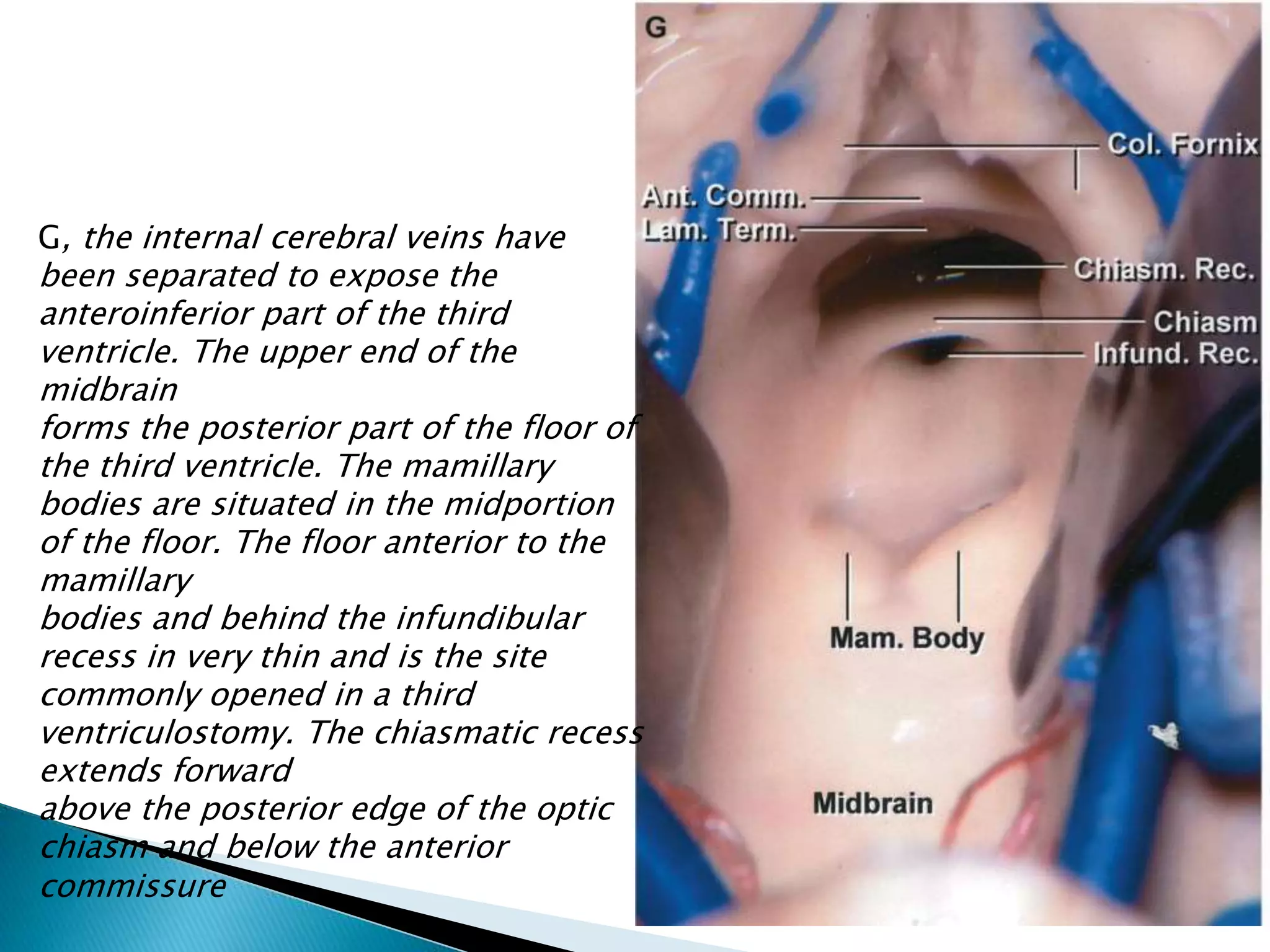 Anatomy of lateral ventricle | PPTX