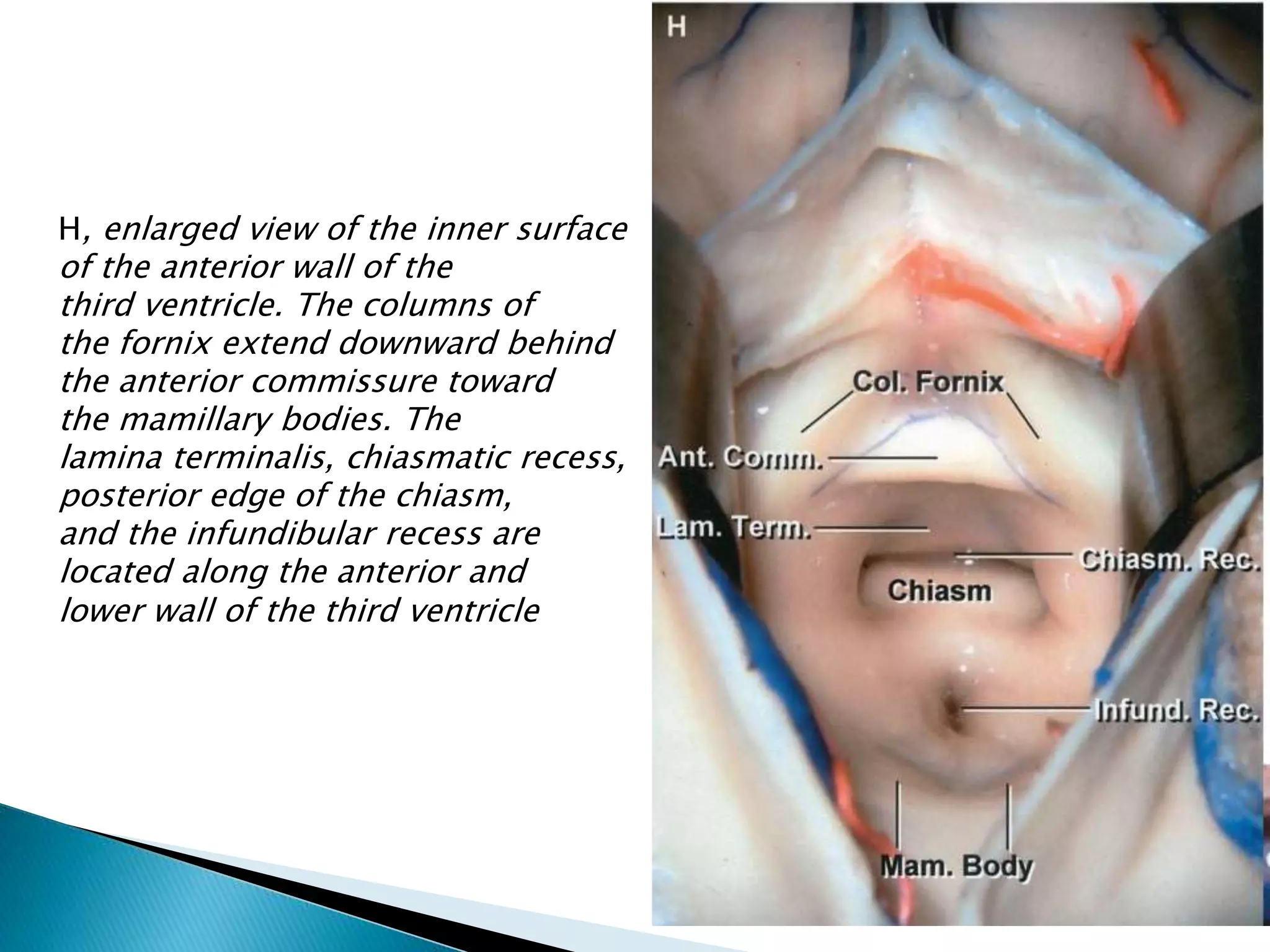 Anatomy of lateral ventricle | PPTX