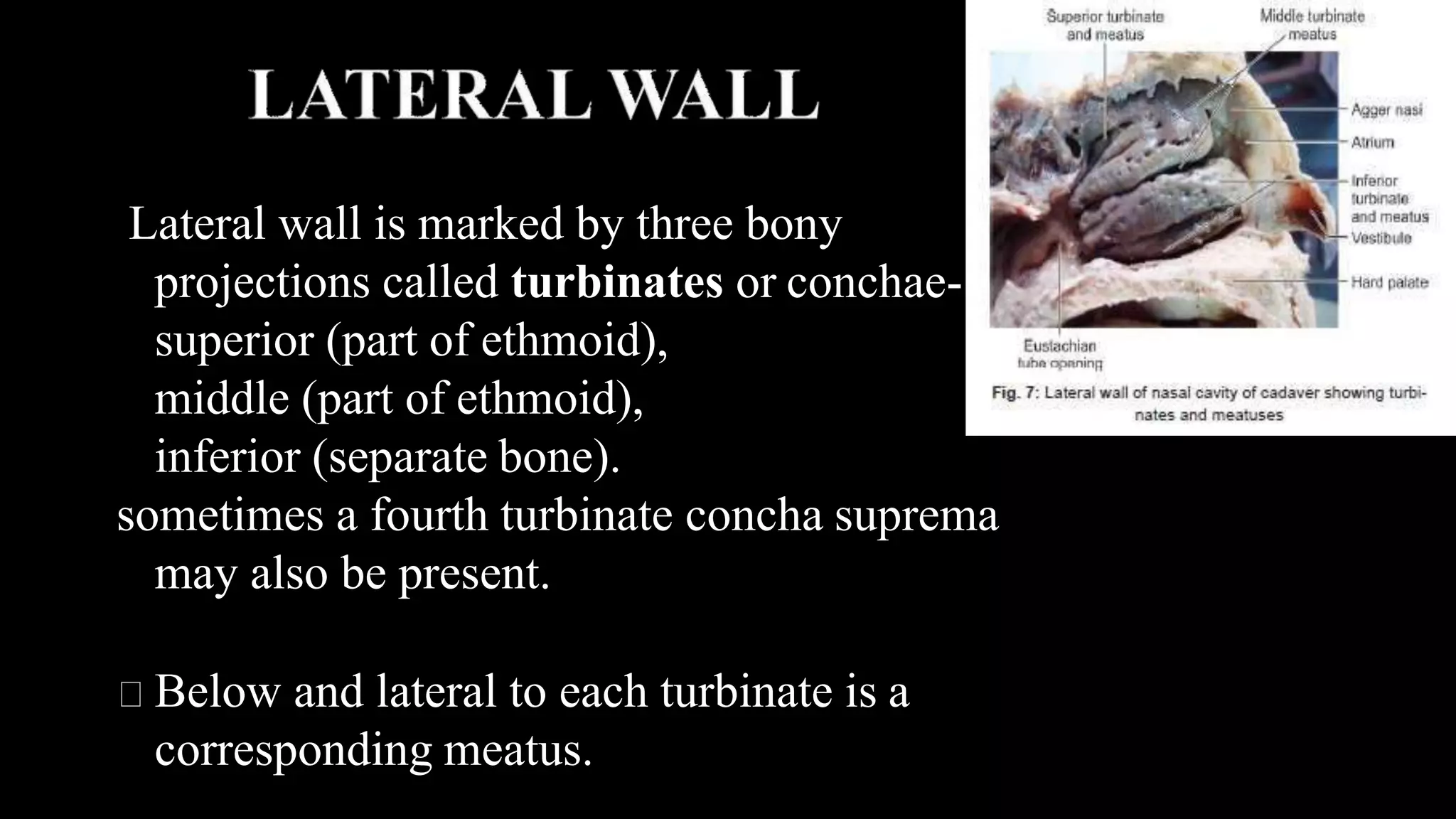Anatomy of lateral wall of nose | PPTX
