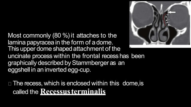 Anatomy of lateral wall of nose | PPTX | Ear, Nose and Throat ...