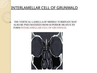 ANATOMY OF LATERAL WALL OF NOSE.pptx detailed | PPTX