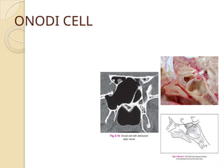 ANATOMY OF LATERAL WALL OF NOSE.pptx detailed | PPTX