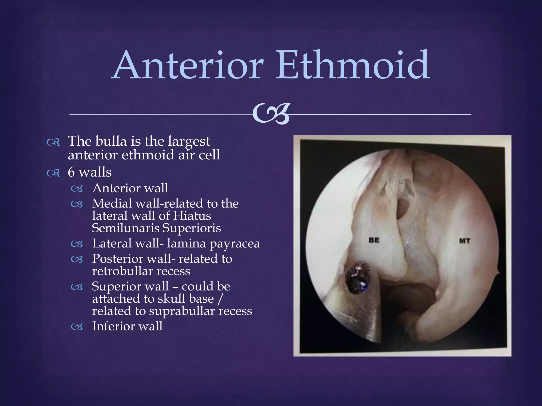 Anatomy of lateral wall of nose with relevance | PPTX