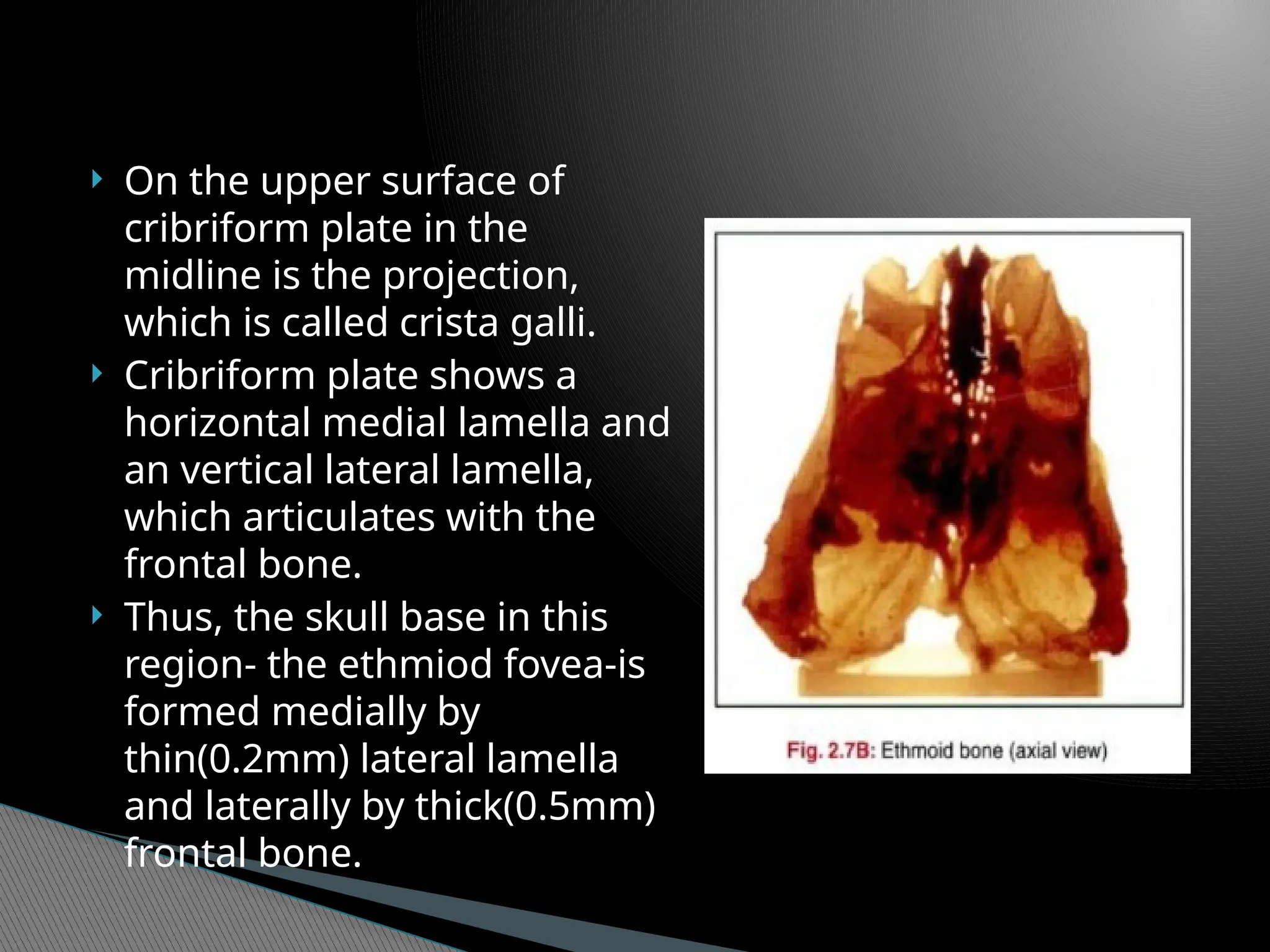Anatomy of lateral wall of the nose.pptx