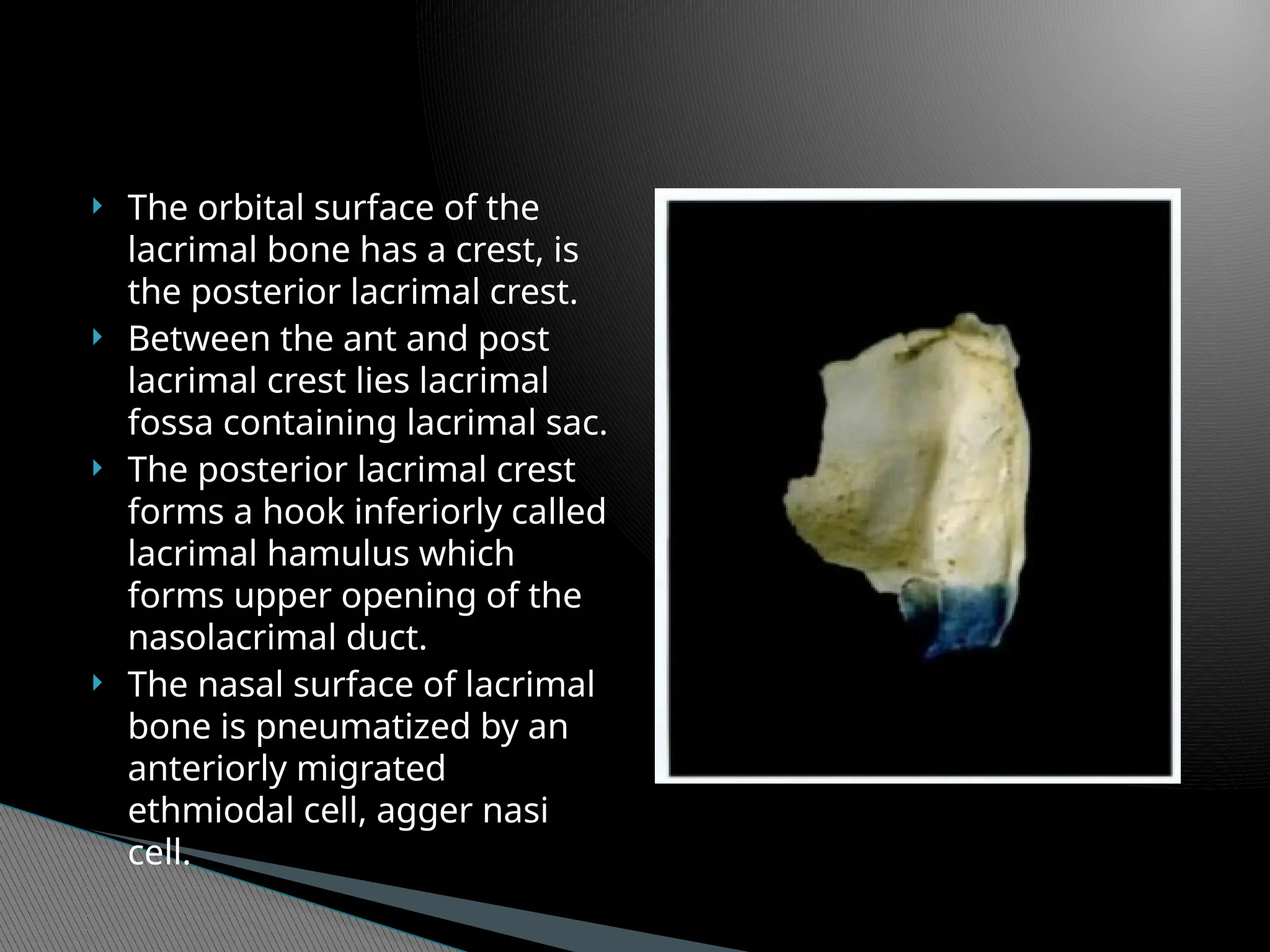 Anatomy of lateral wall of the nose.pptx