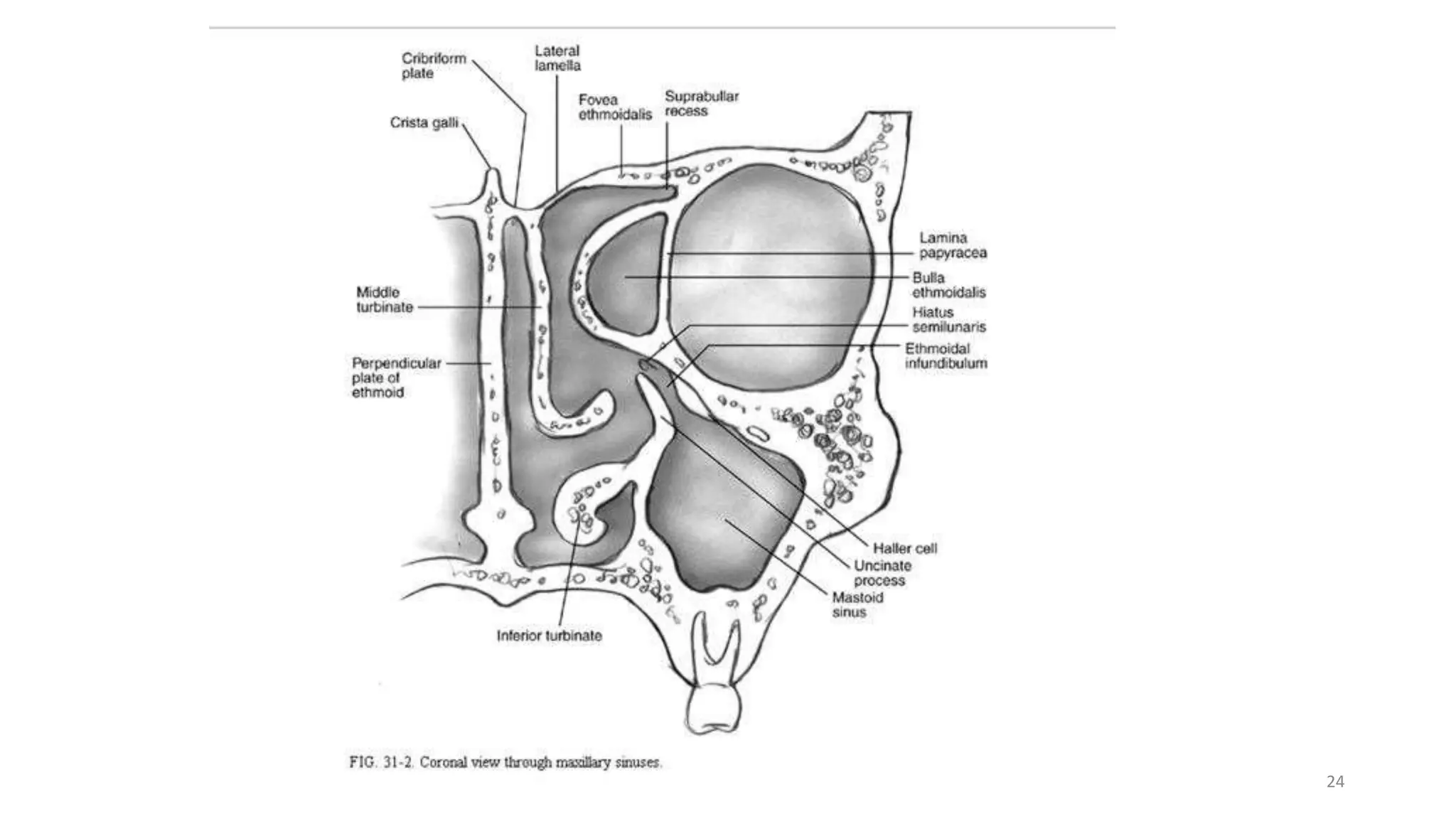 ANATOMY OF LATERAT WALL NOSE OMC.pptx