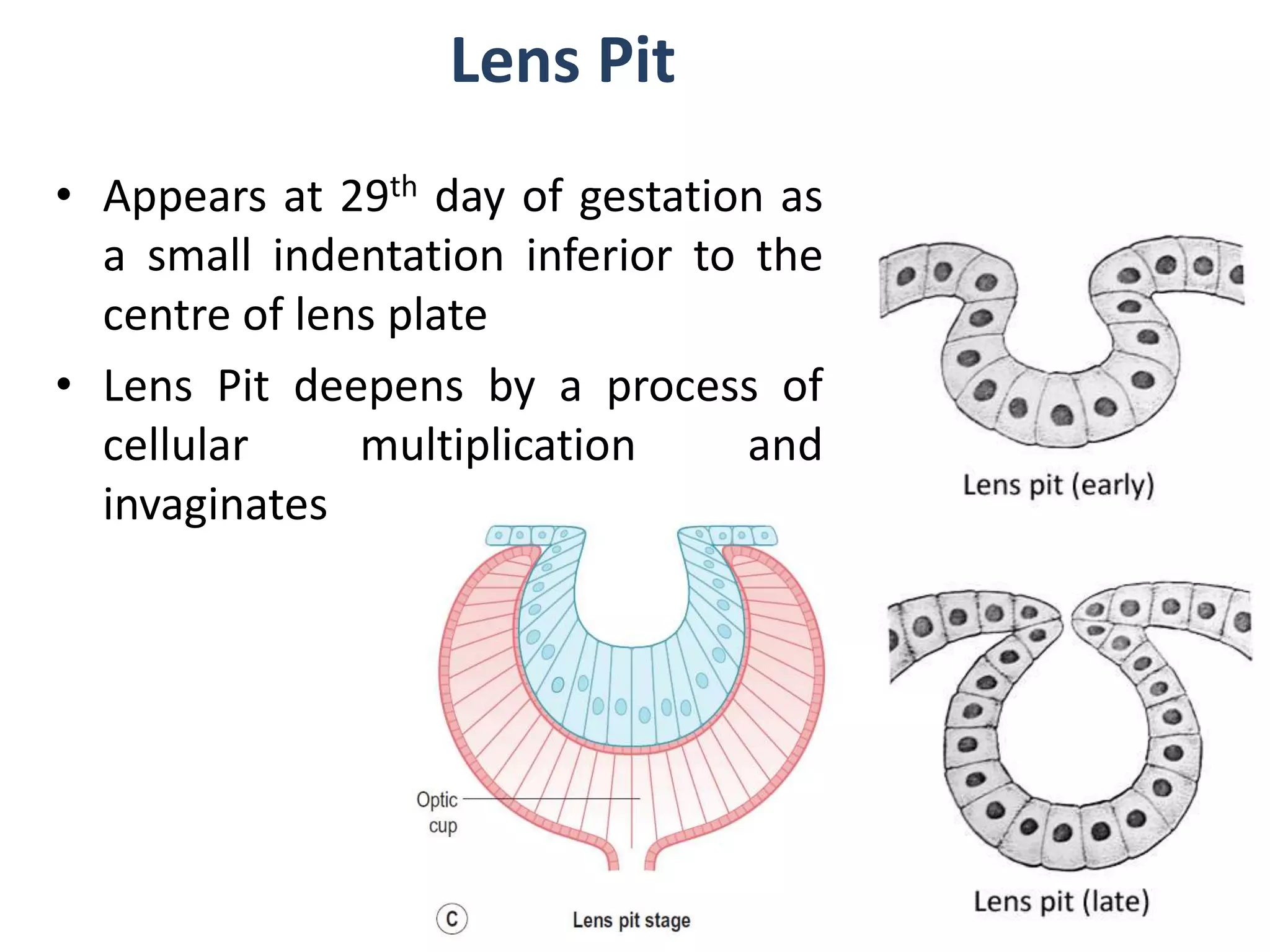 Anatomy of lens | PPTX | Eye and Vision Conditions | Diseases and ...