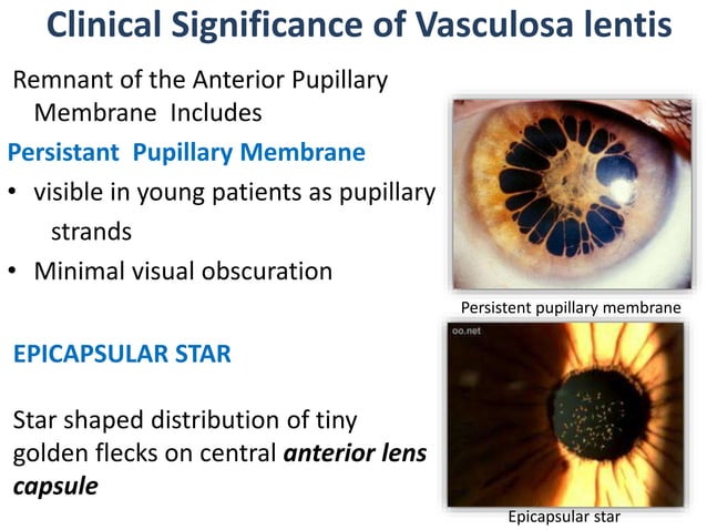 Anatomy of lens | PPTX | Eye and Vision Conditions | Diseases and ...