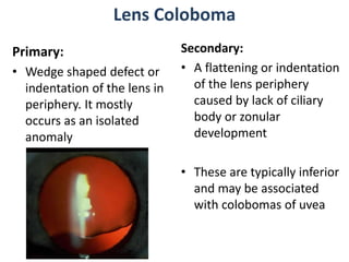 Anatomy of lens | PPTX