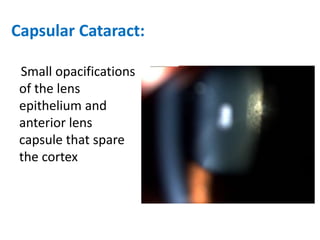 Anatomy of lens | PPTX