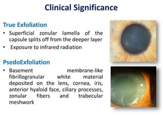 Anatomy of lens | PPTX | Eye and Vision Conditions | Diseases and ...