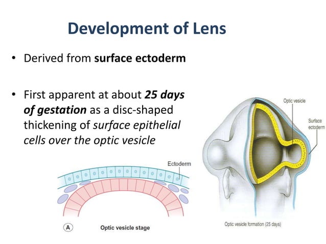 Anatomy of lens | PPTX | Eye and Vision Conditions | Diseases and ...