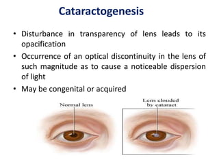 Anatomy of lens | PPTX