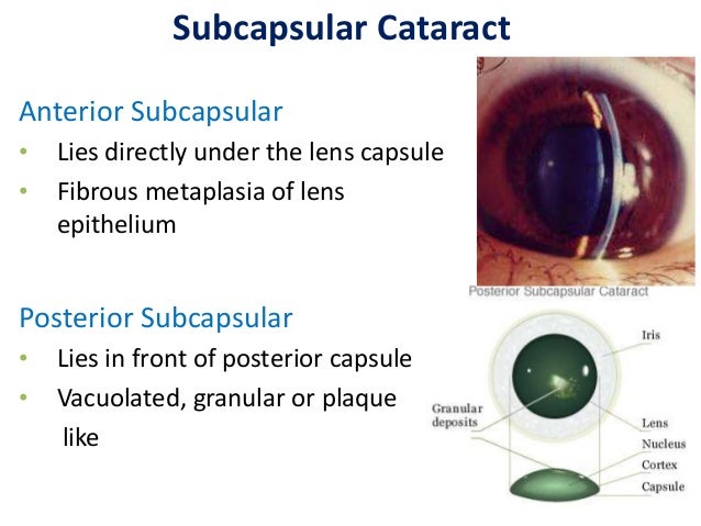 Anatomy Of Lens