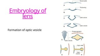 Anatomy of Lens and physiology of lens ppt | PPTX