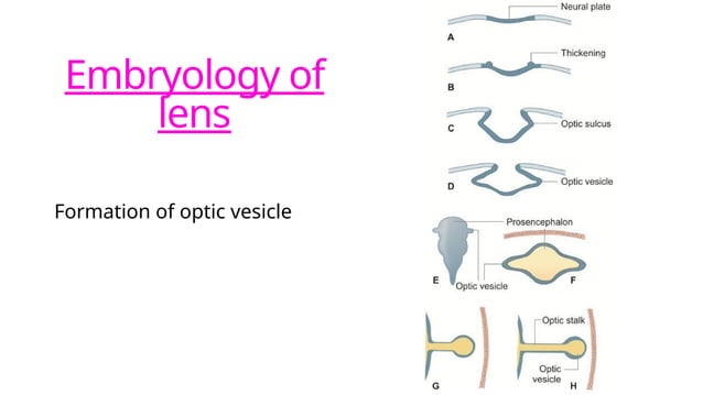 Anatomy of Lens and physiology of lens ppt | PPT