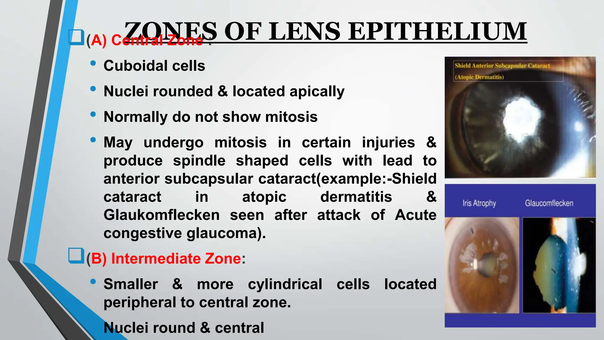 ANATOMY OF LENS AND FACTORS AFFECTING LENS TRANSPARENCY.pptx