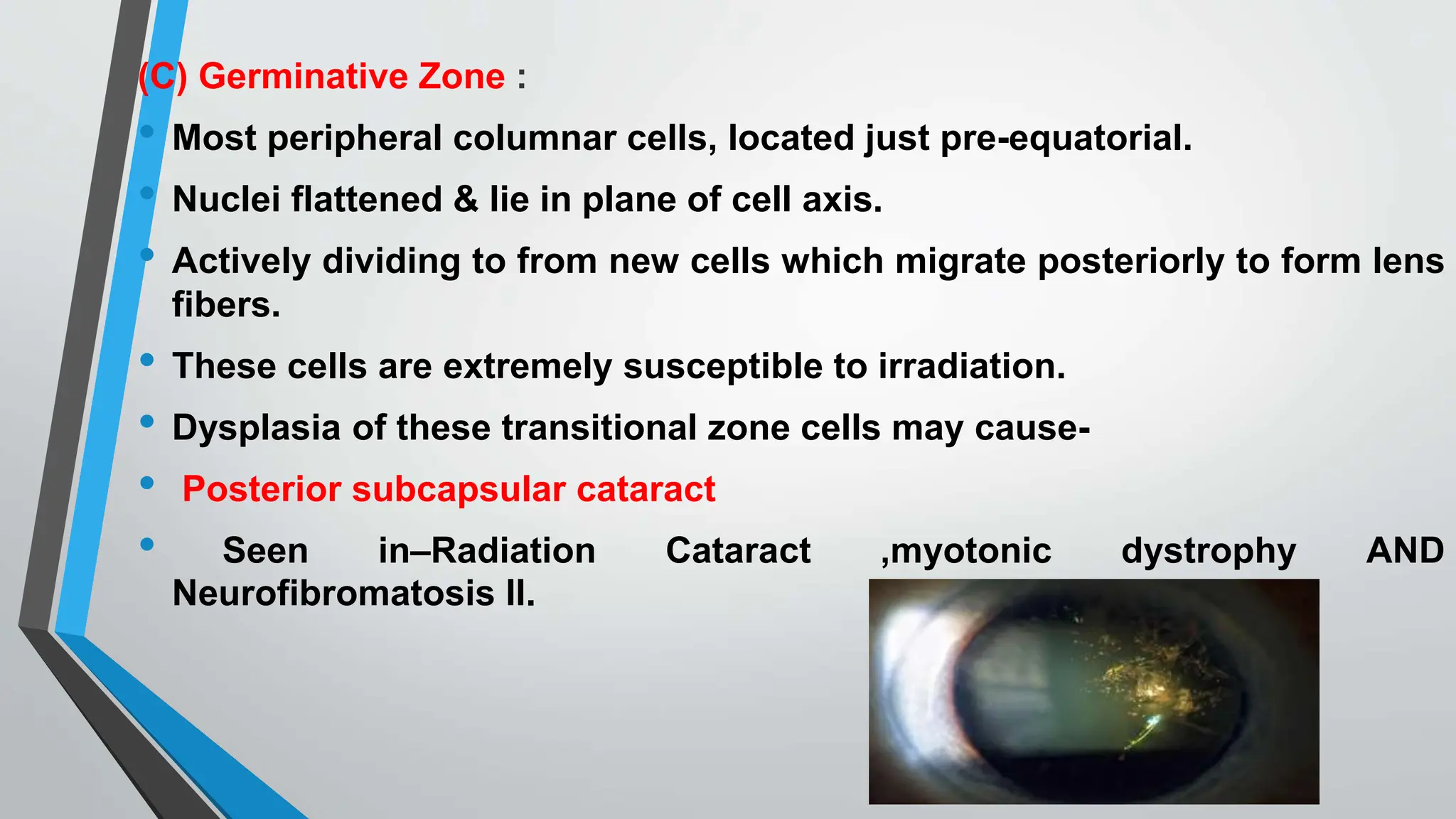 ANATOMY OF LENS AND FACTORS AFFECTING LENS TRANSPARENCY.pptx