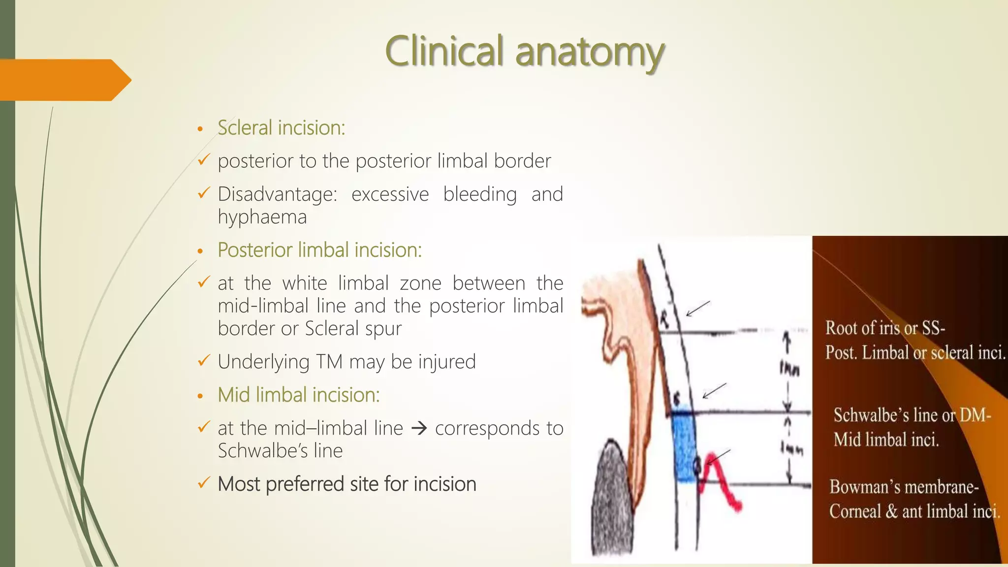 Anatomy of limbus, Stem cell deficiency.pptx